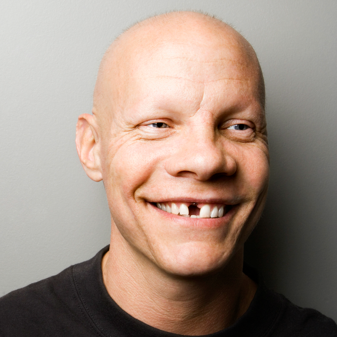 Why Replacing Missing Teeth Is Important Hiossen Implant