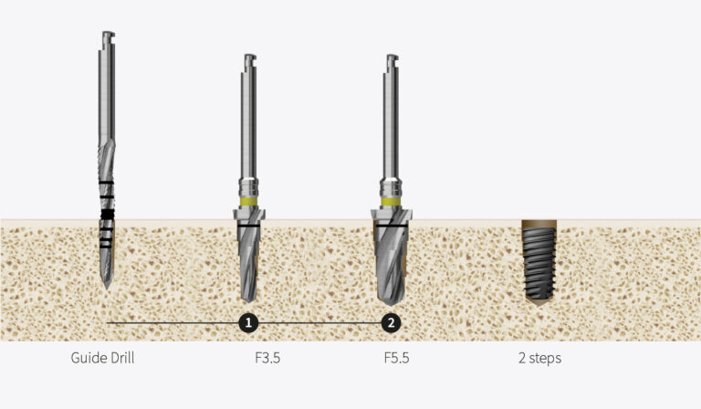 122 Taper Kit - Hiossen® Implant