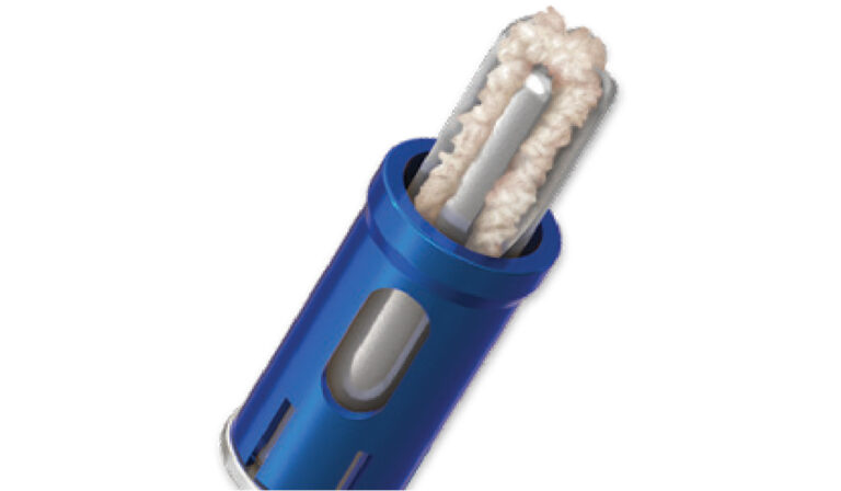 CAS Kit - Hiossen® Implant