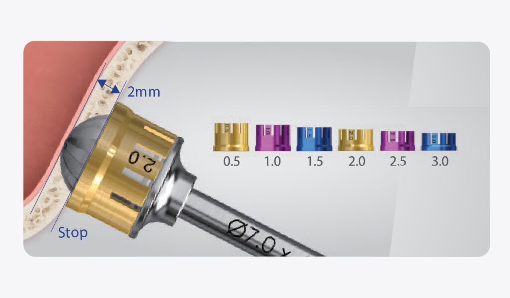 LAS Kit - Hiossen® Implant