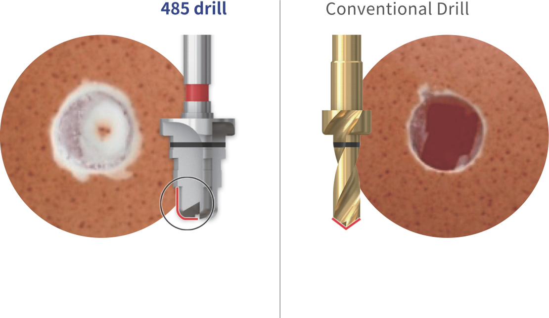 485 Kit - Hiossen® Implant