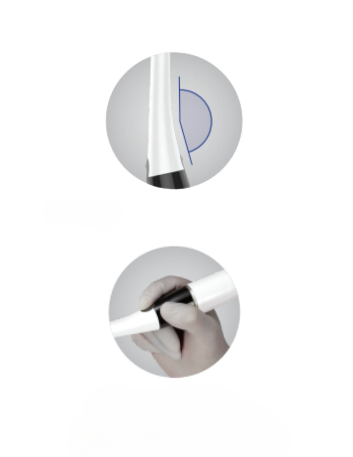 Snap - Hiossen® Implant
