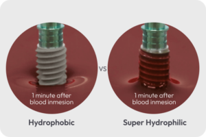 EK Implant System - Hiossen® Implant